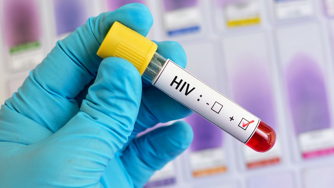 New HIV strain discovered; first in 19 years | khou.com
