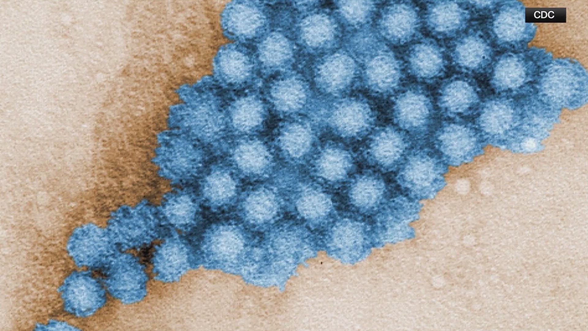 CDC: Norovirus cases are on the rise | khou.com