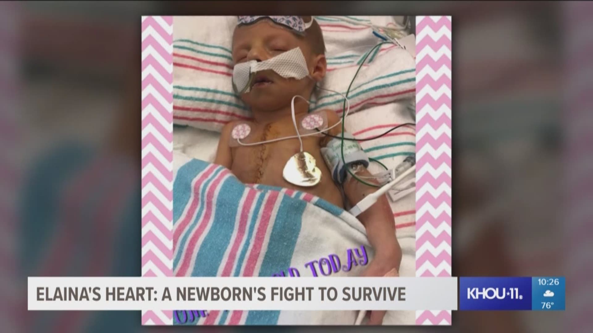 'Elaina’s a miracle baby:' Newborn given 30-percent chance to live ...