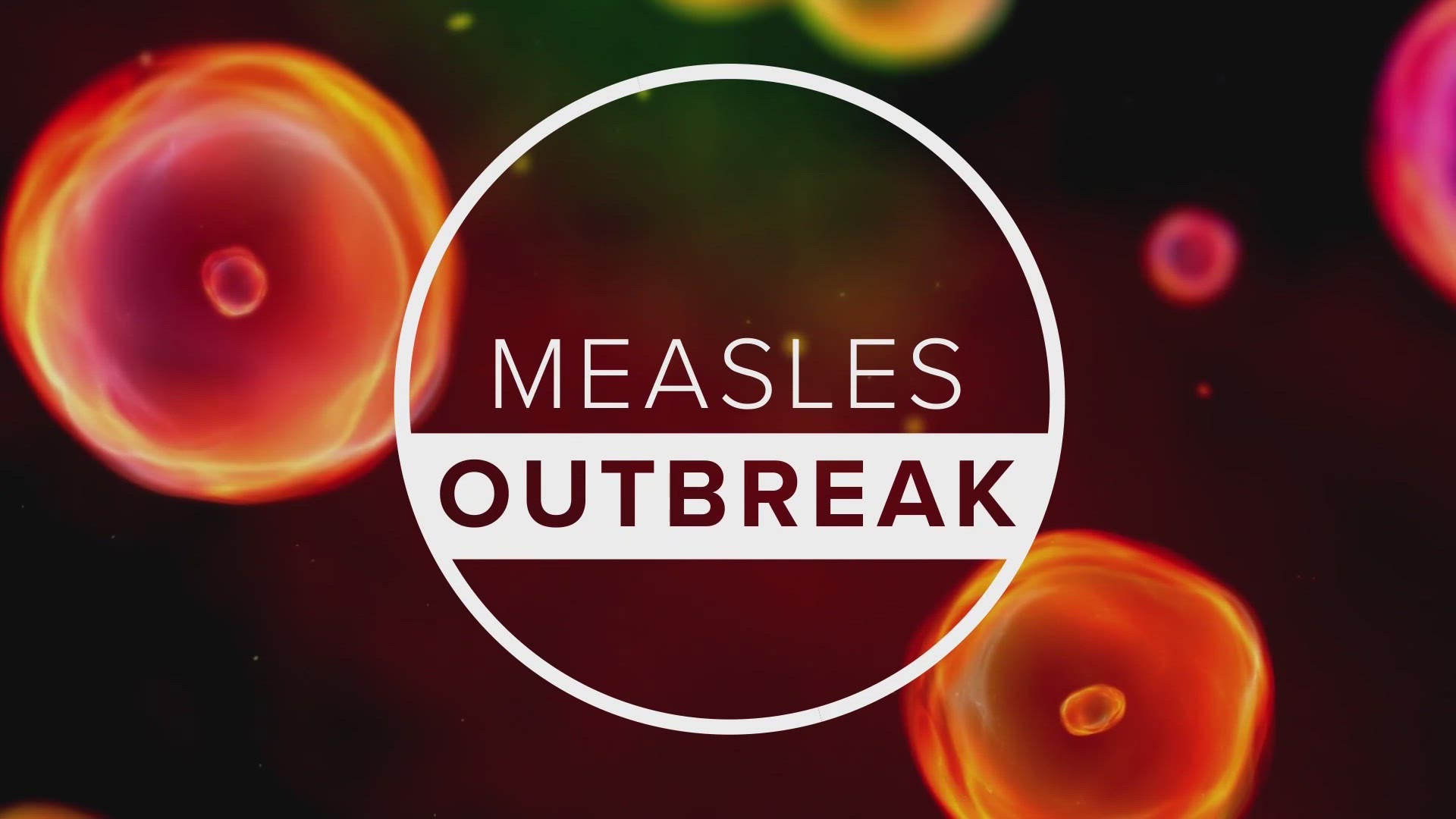 Texas measles cases rise to 309 with 40 hospitalizations | khou.com