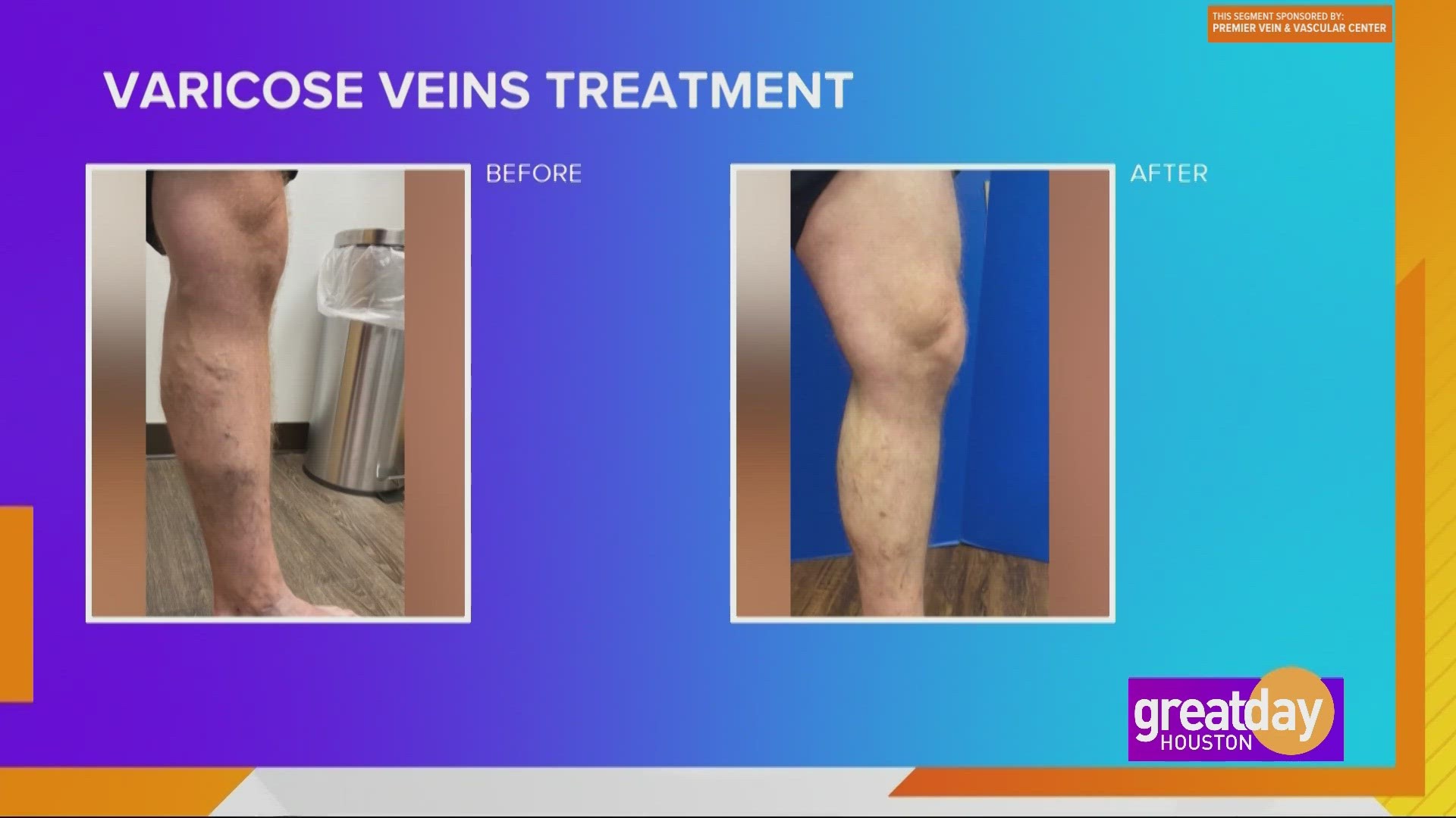 Sponsored: Fall In Love With Your Legs Again | khou.com