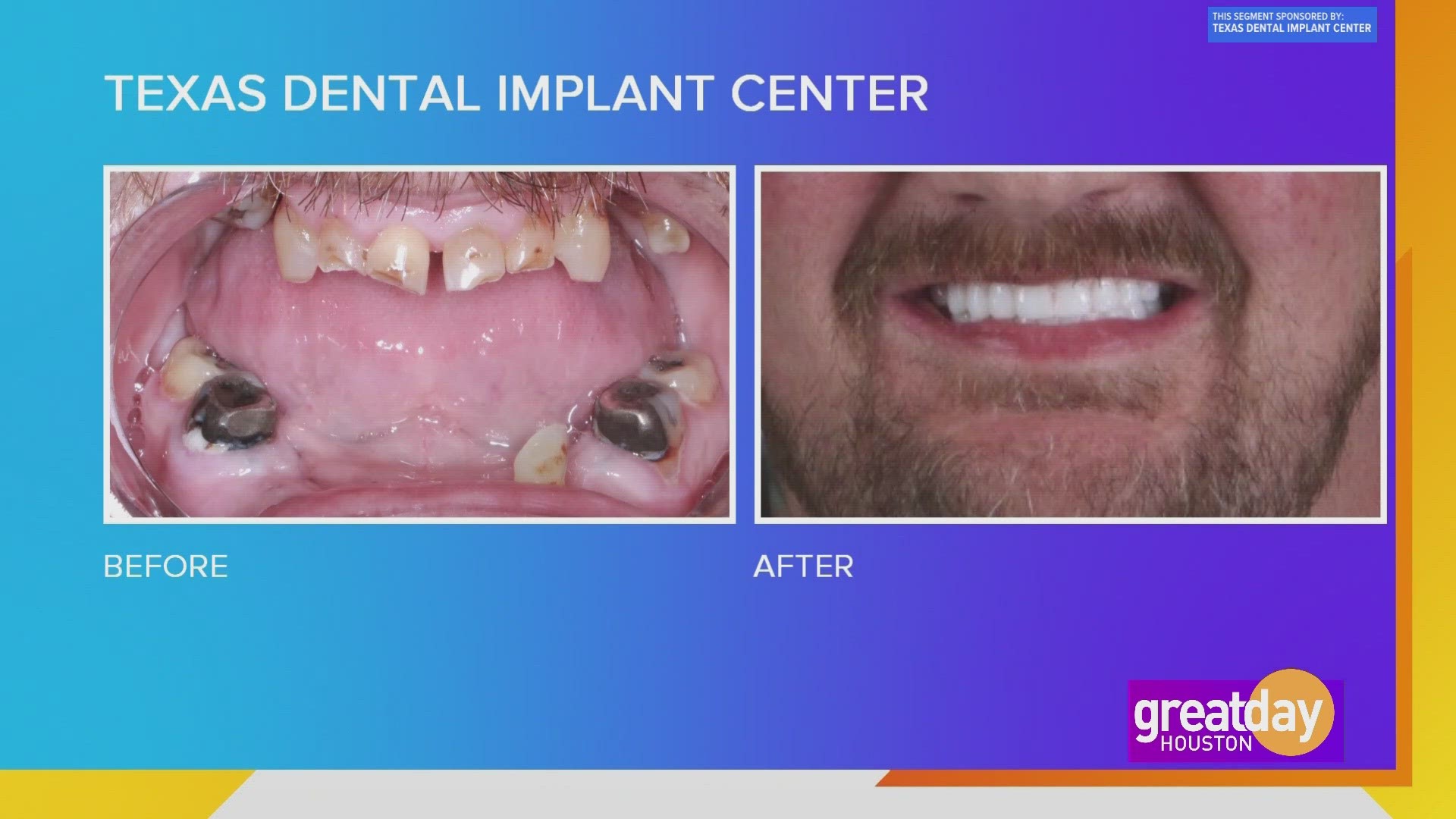 Sponsored: Texas Dental Implant Center can help you start 2024 off with ...