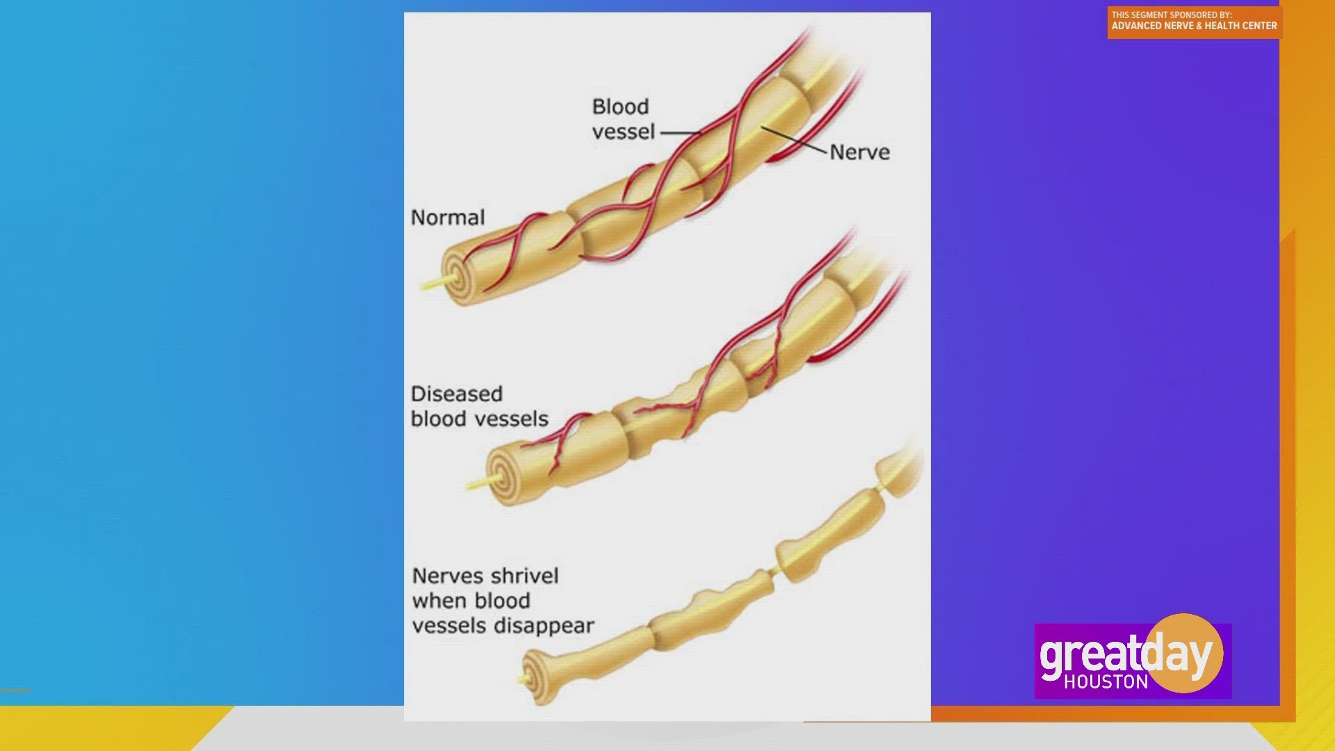 Advanced Nerve and Health Center can help treat neuropathy | khou.com