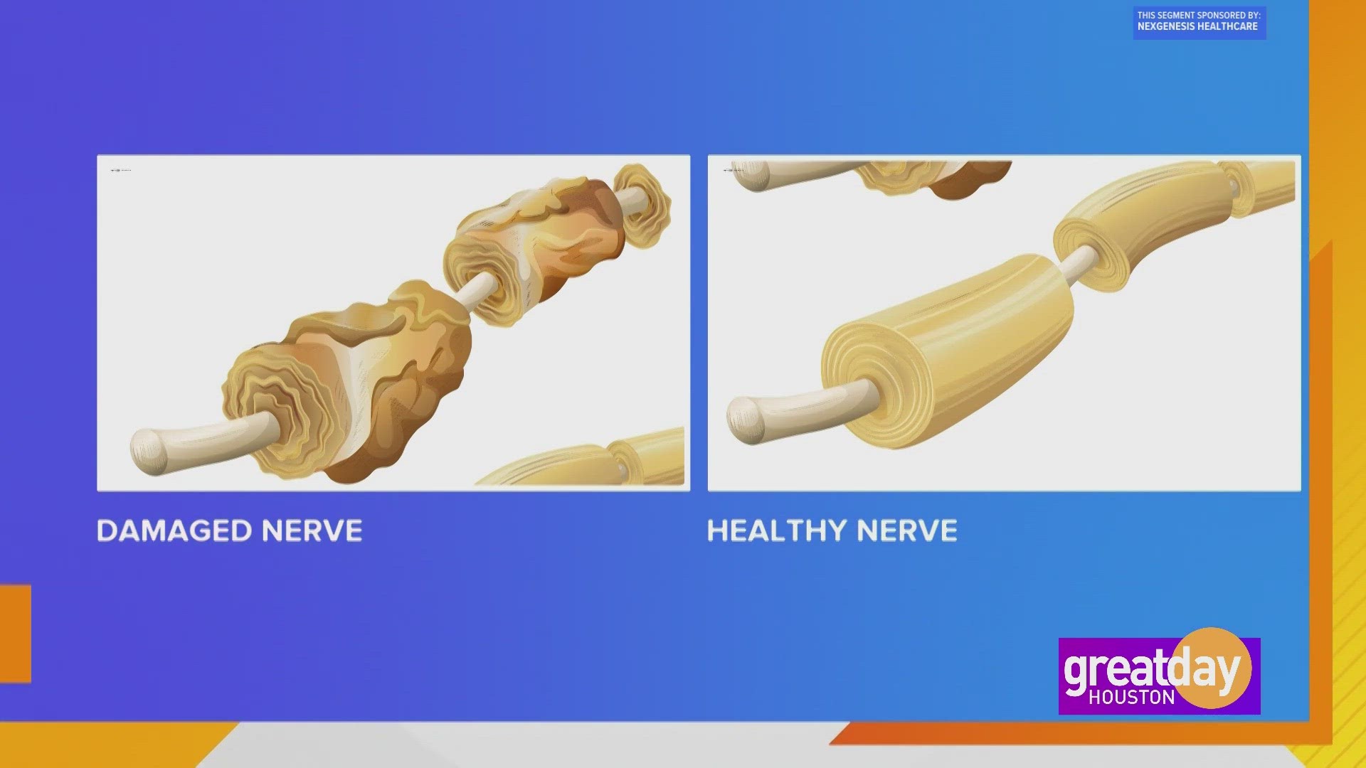 Sponsored: Lasting relief in your joints, ligaments and muscles with ...