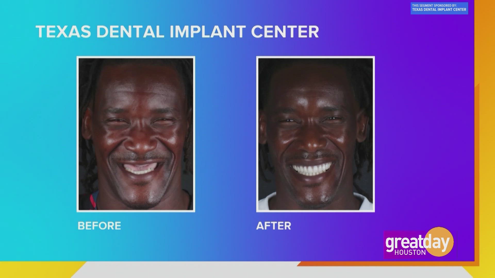 Get a smile as bright as gold with help from Texas Dental Implant ...