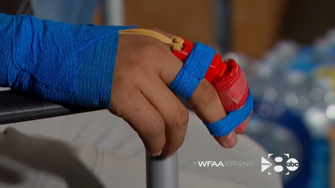 Fort Worth baseball player finds hope in 3D-printed prosthetic finger ...