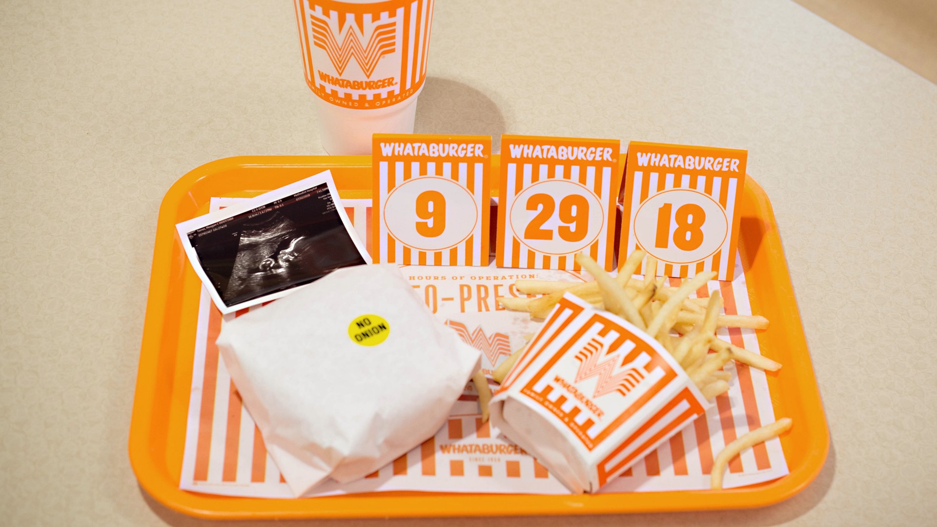 Photos: Houston-area mom poses for adorable maternity photos at ...