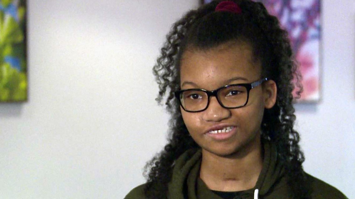 Houston teen smiling again after surgery for rare gum tumor | khou.com