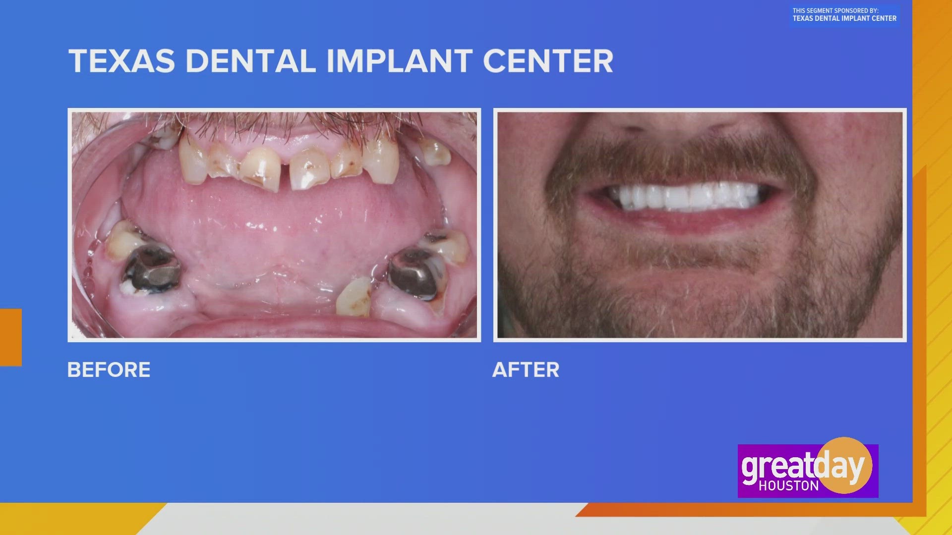 Sponsored: Get a new smile with help from Texas Dental Implant Center ...