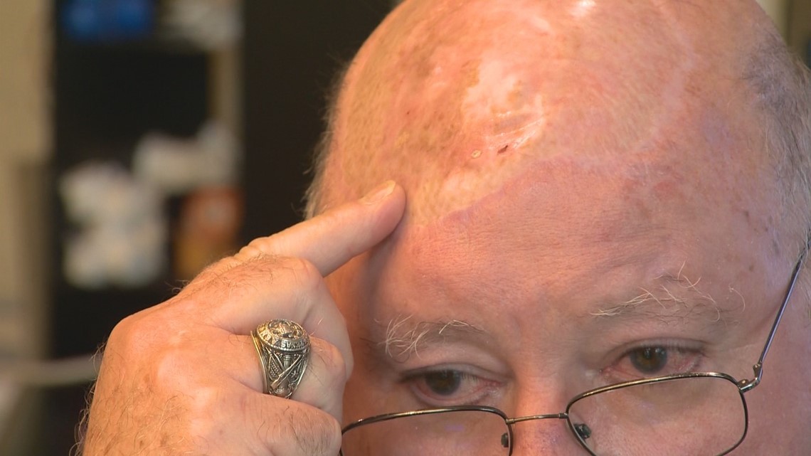 San Antonio research leads to FDA approval for skin cancer drug | khou.com