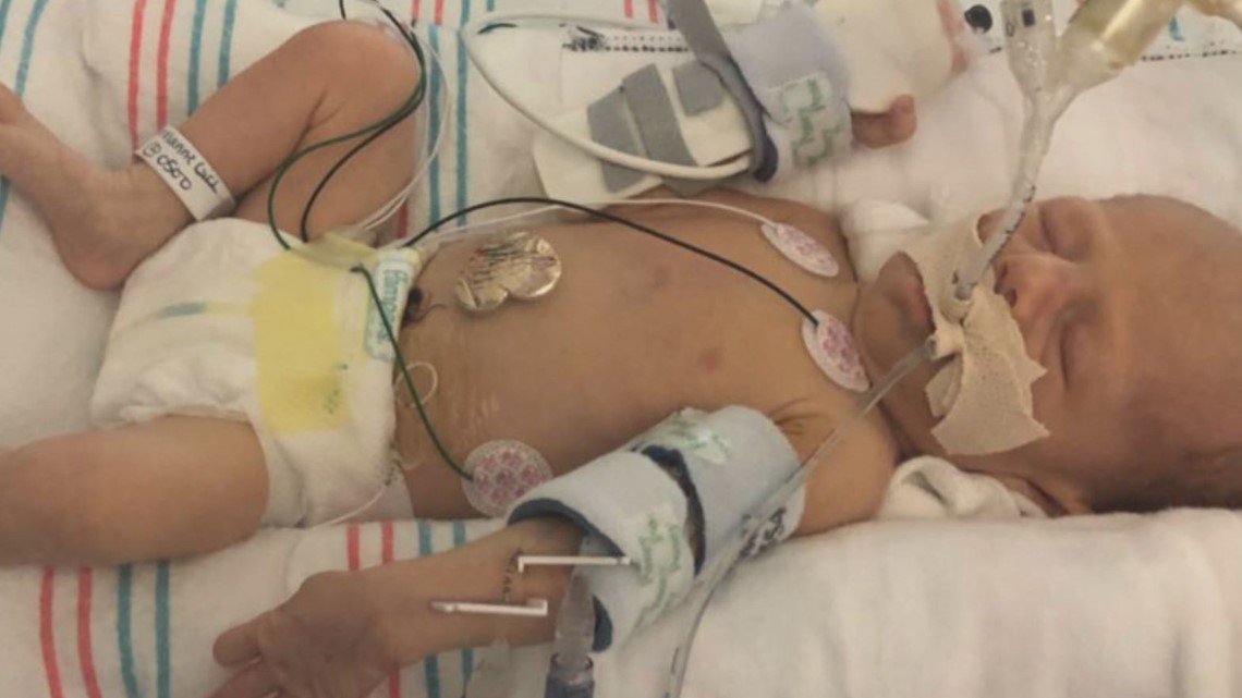 'Elaina’s a miracle baby:' Newborn given 30-percent chance to live ...