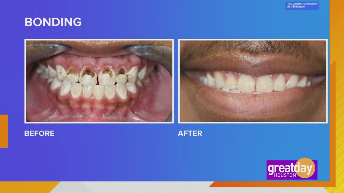 Sponsored: Dr. Terri Alani shares affordable ways to upgrade your smile ...