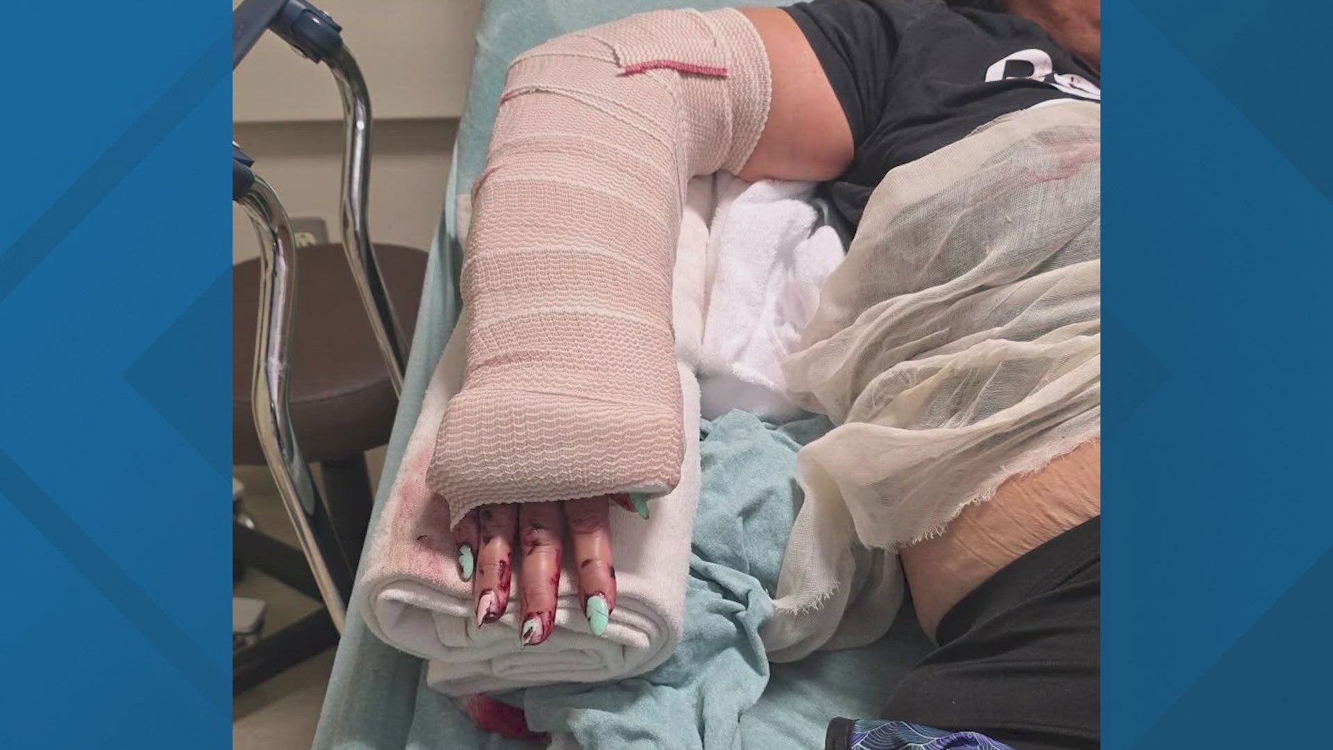 Nanny says stranger attacked her with baseball bat while walking baby ...