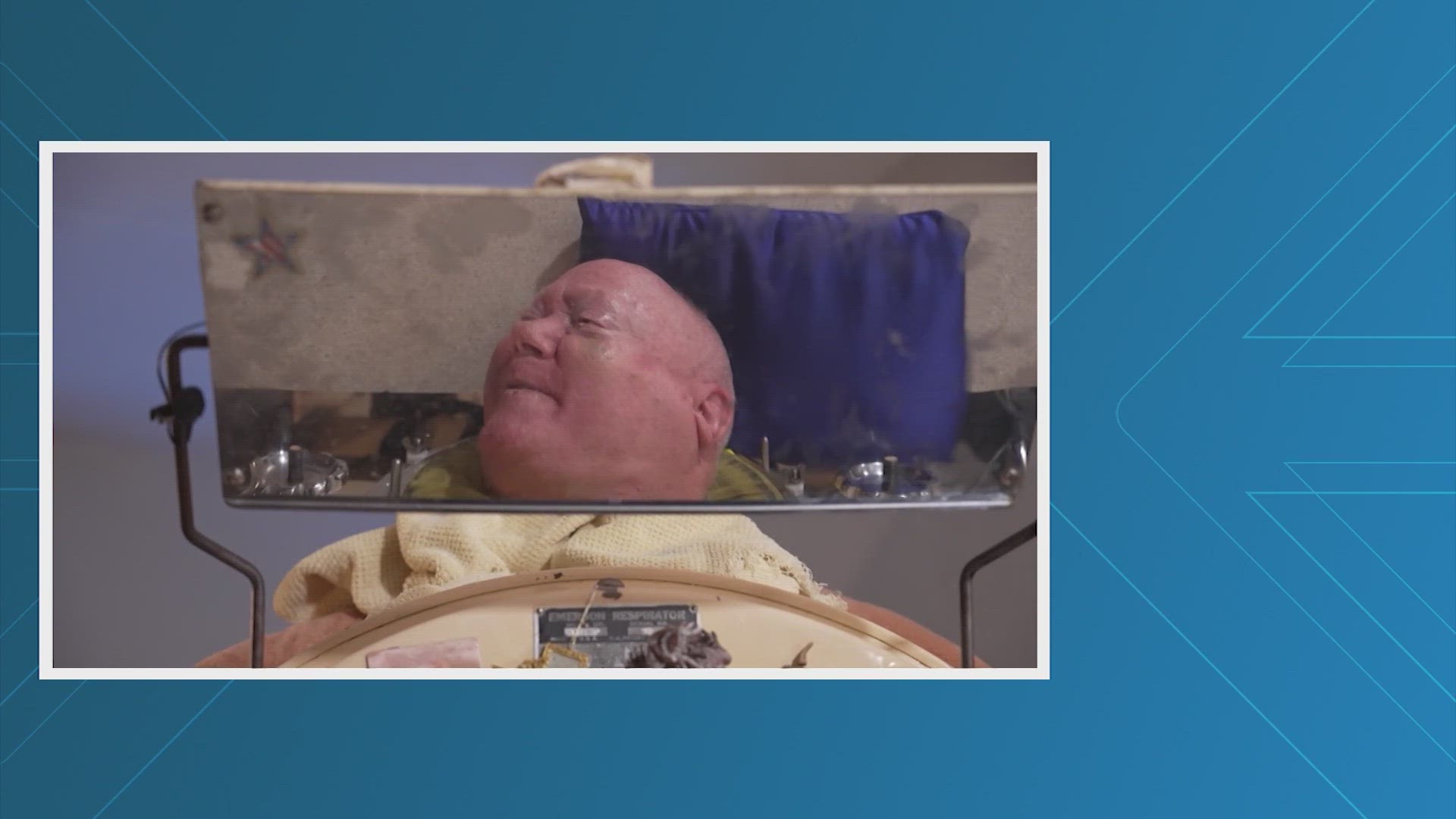Dallas man who lived in an iron lung for 70-plus years has died | khou.com