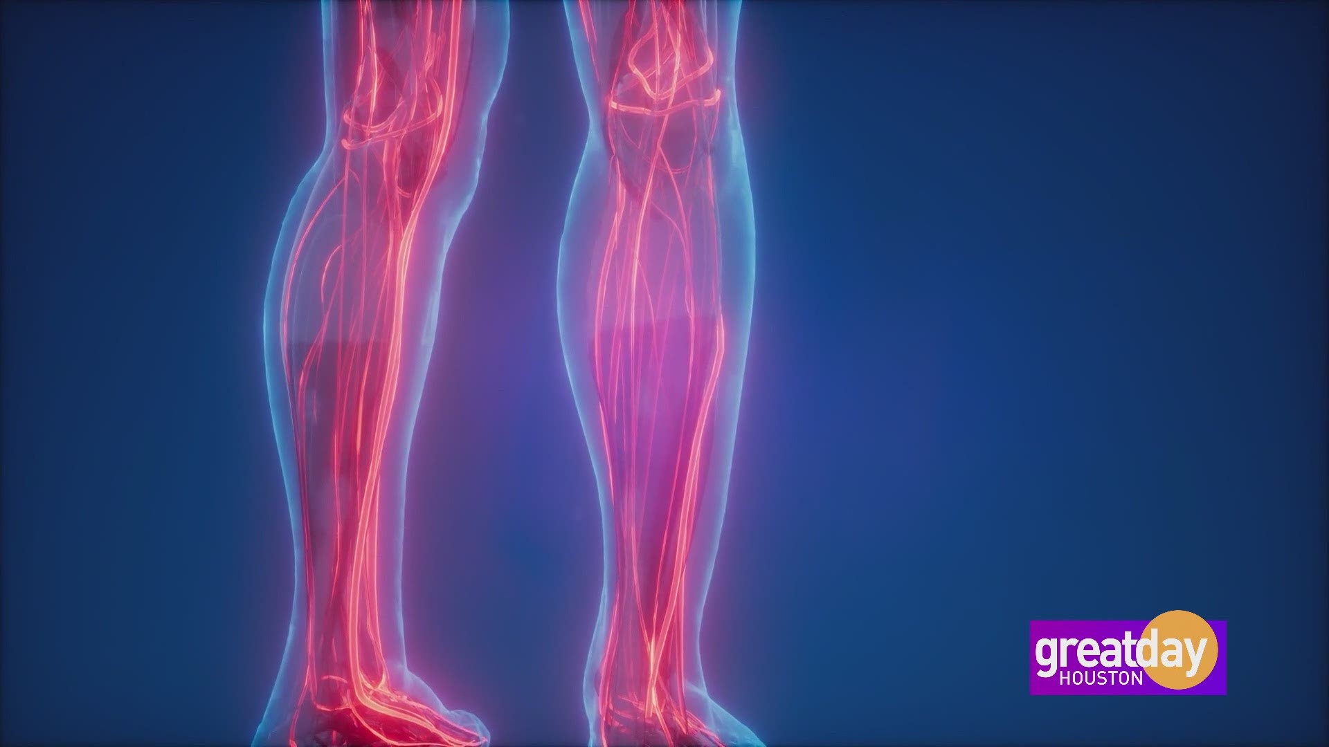 Find out what's causing your leg pain | khou.com