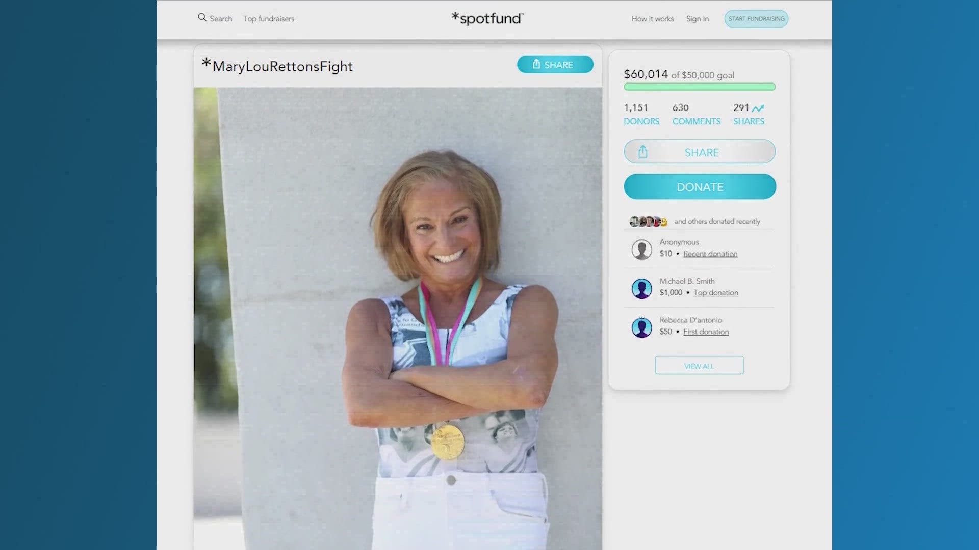 Olympic gymnast Mary Lou Retton battles rare form of pneumonia ...