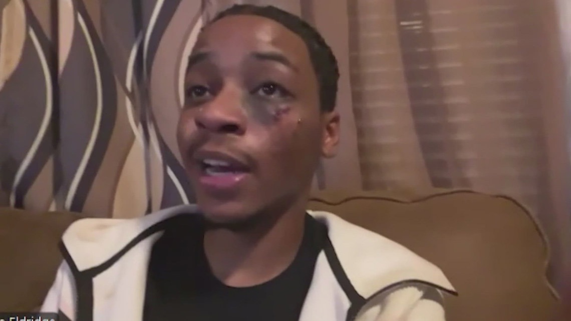 Houston fan's night out ends in ER after glass thrown at 'Baddies' club ...