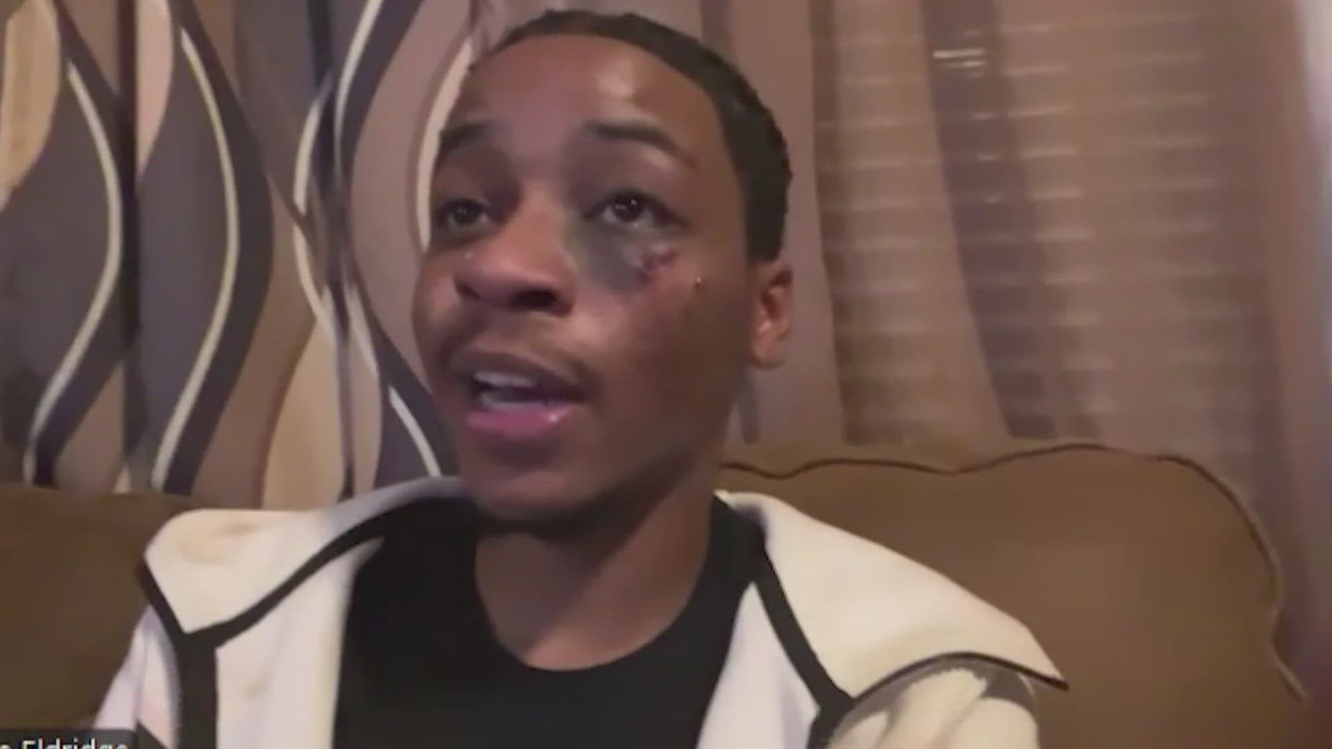 'It was traumatizing' | Houston fan's night out ends in ER after glass ...