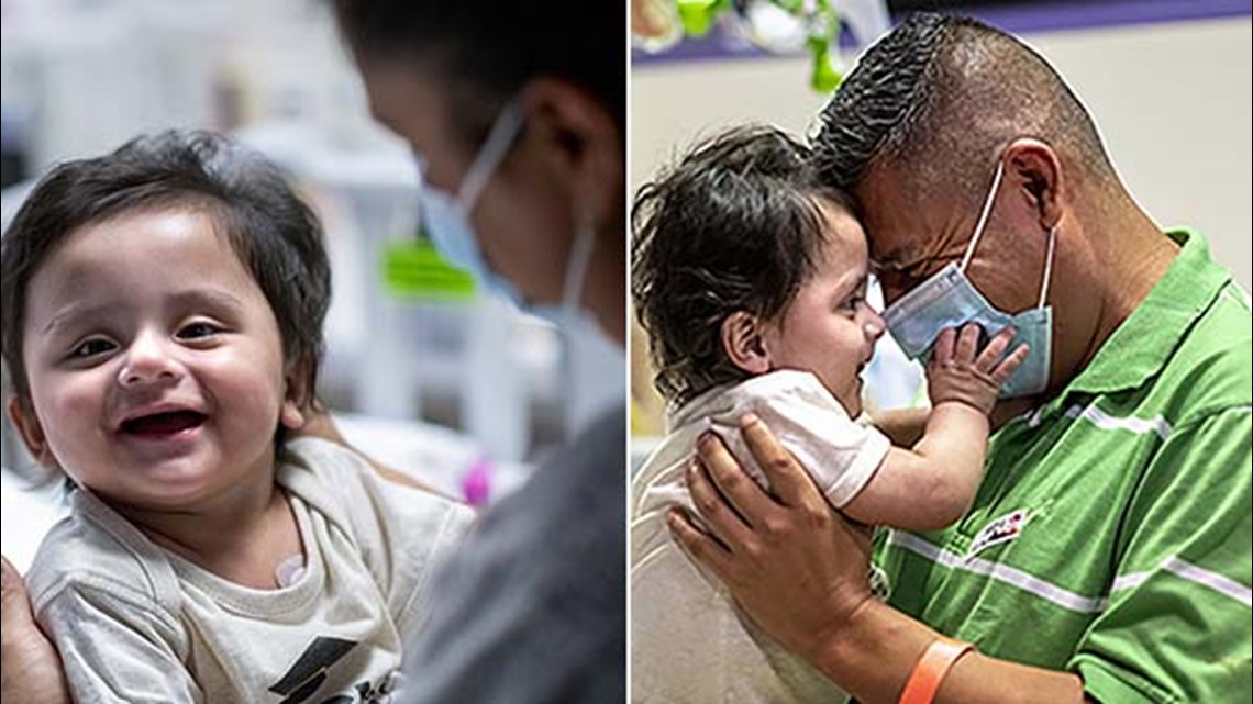 Meet Lucas and Mateo: Formerly conjoined twins separated at TCH | khou.com