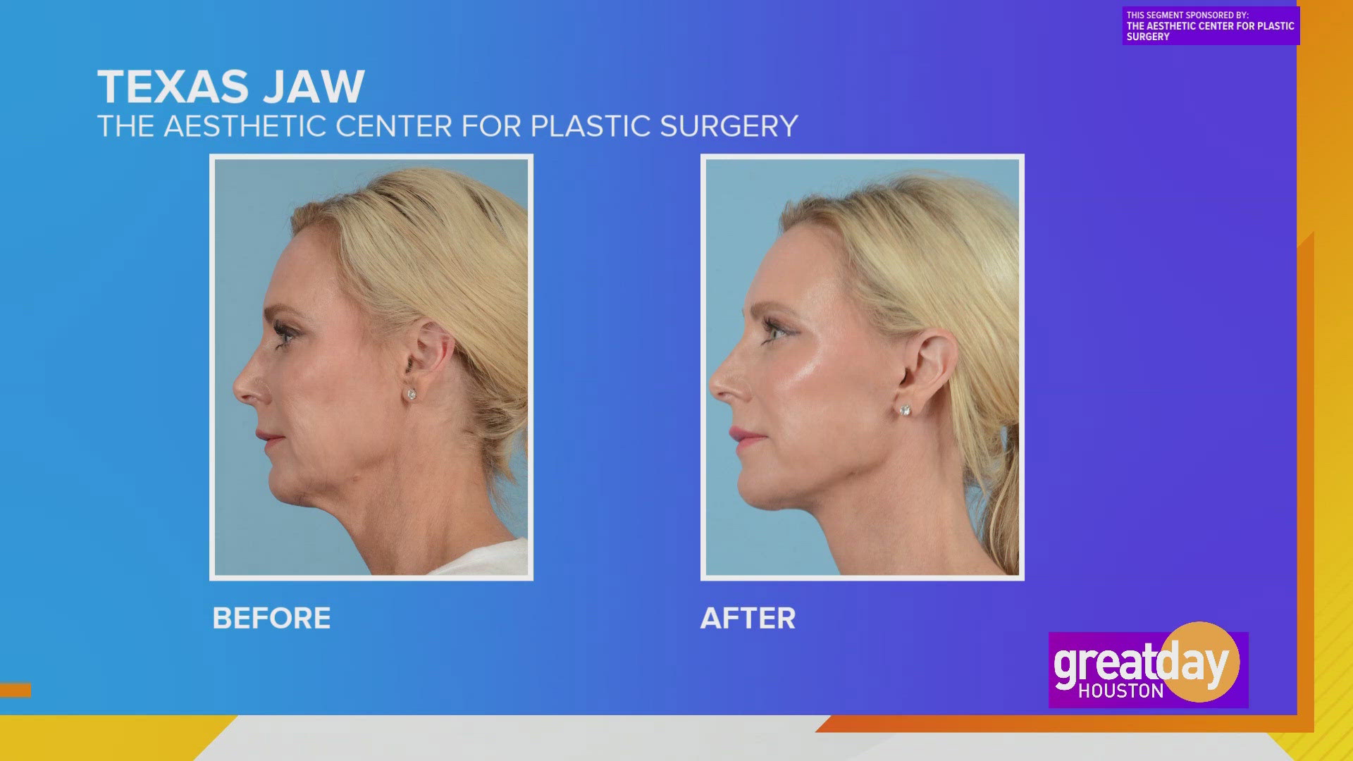 Sponsored: Restore Your Youth with Dr. Henry Mentz | khou.com