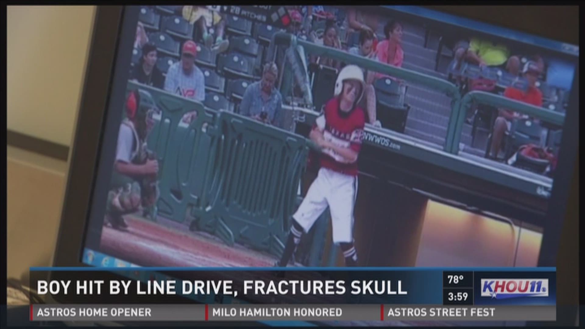 Flying baseball fractures boy's skull | khou.com
