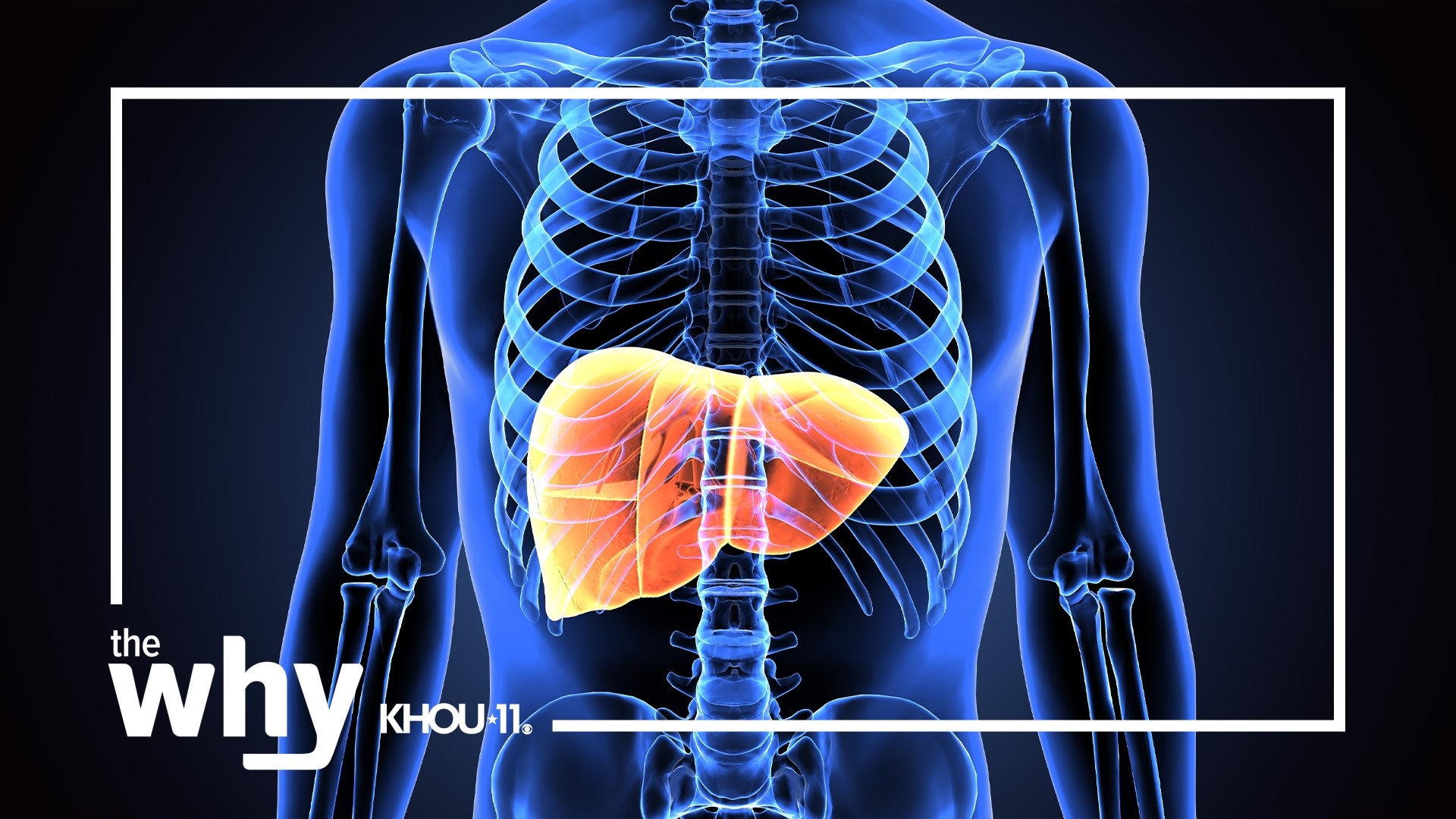 Fatty liver disease increasing in children | khou.com