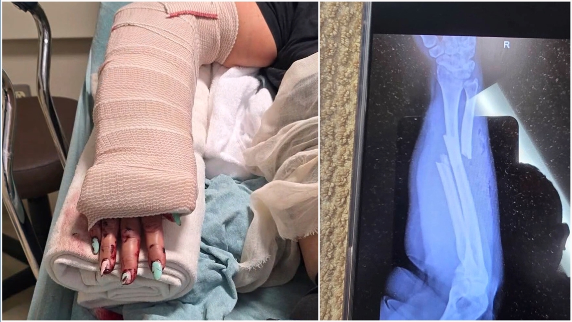'I could have been killed' | Nanny says stranger attacked her with ...