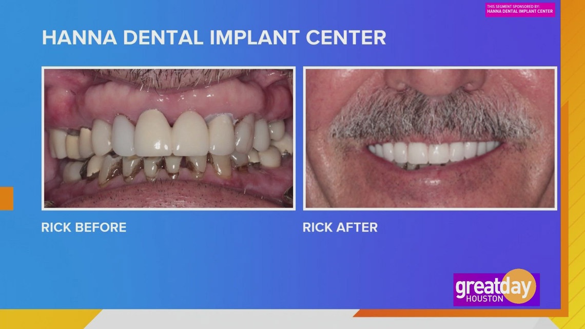 Sponsored: Rick finally overcame his genetically bad teeth thanks Hanna ...
