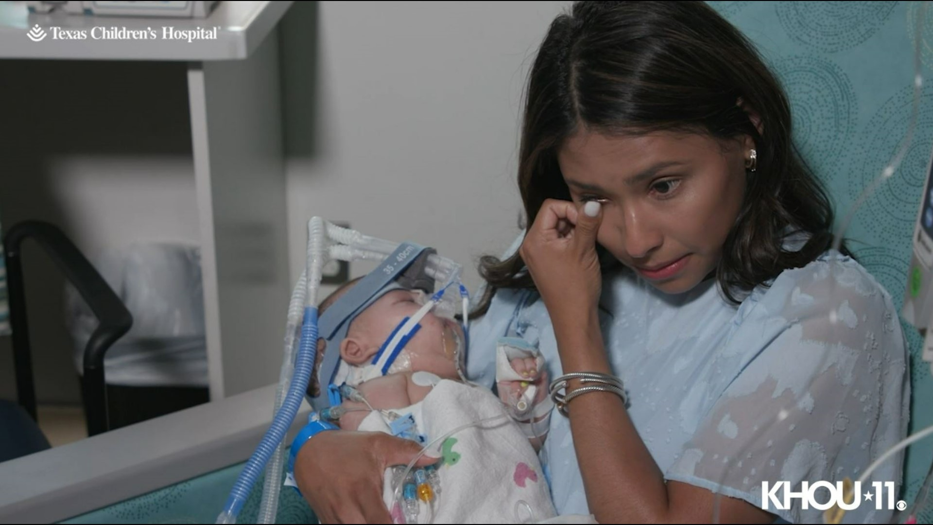 Mom holds babies for first time after surgery to separate conjoined ...