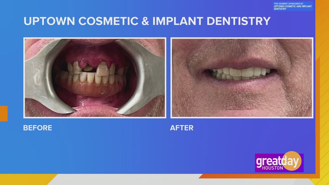 Uptown Cosmetic Implant Dentistry