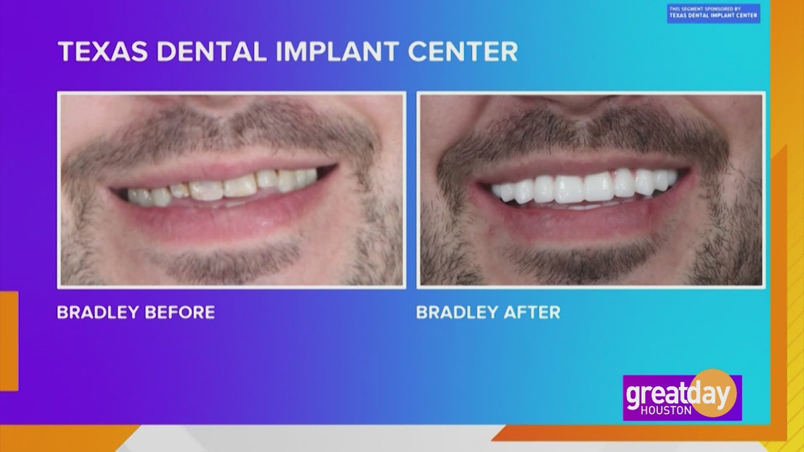 Sponsored: Achieve your dream smile with expert care at Texas Dental ...