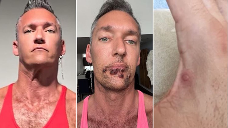 Matt Dougherty | khou.com