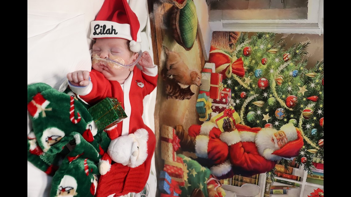 Texas Children's Hospital NICU babies celebrate first Christmas | khou.com
