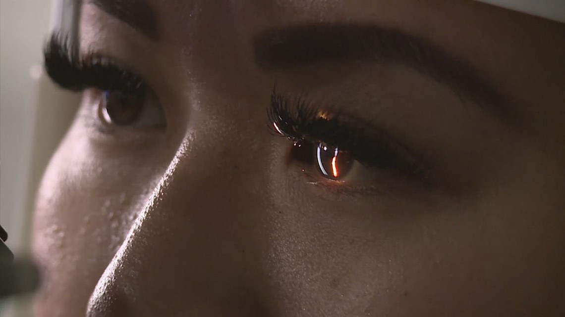 How clinical trial is changing corneal transplants | khou.com