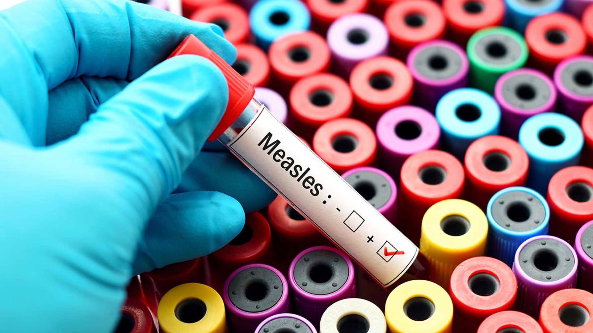 Measles cases confirmed in Houston | Symptoms, prevention and high-risk ...