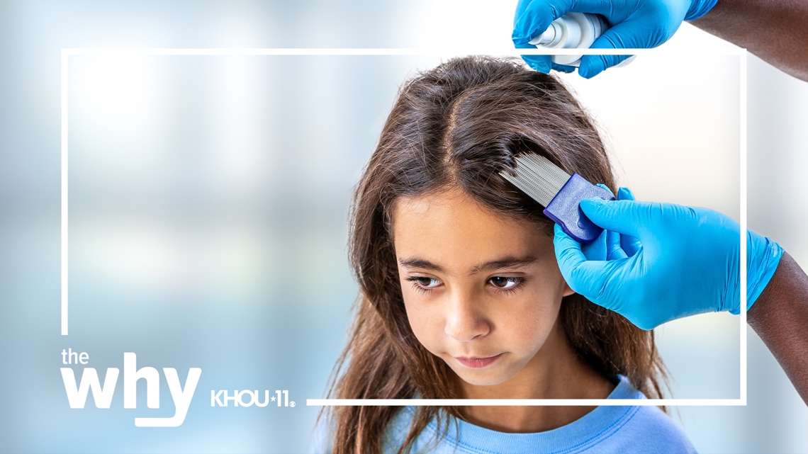 Why did CDC change guidance on lice in schools? | khou.com