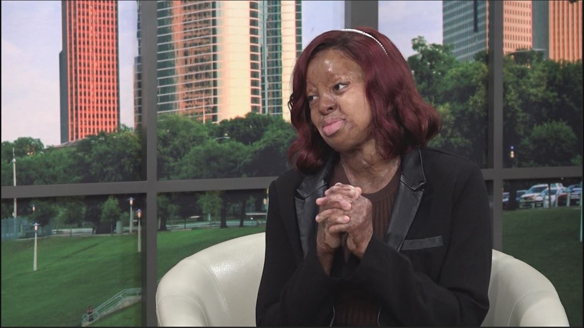 Kechi Okwuchi on her memoir, "More Than My Scars" | khou.com