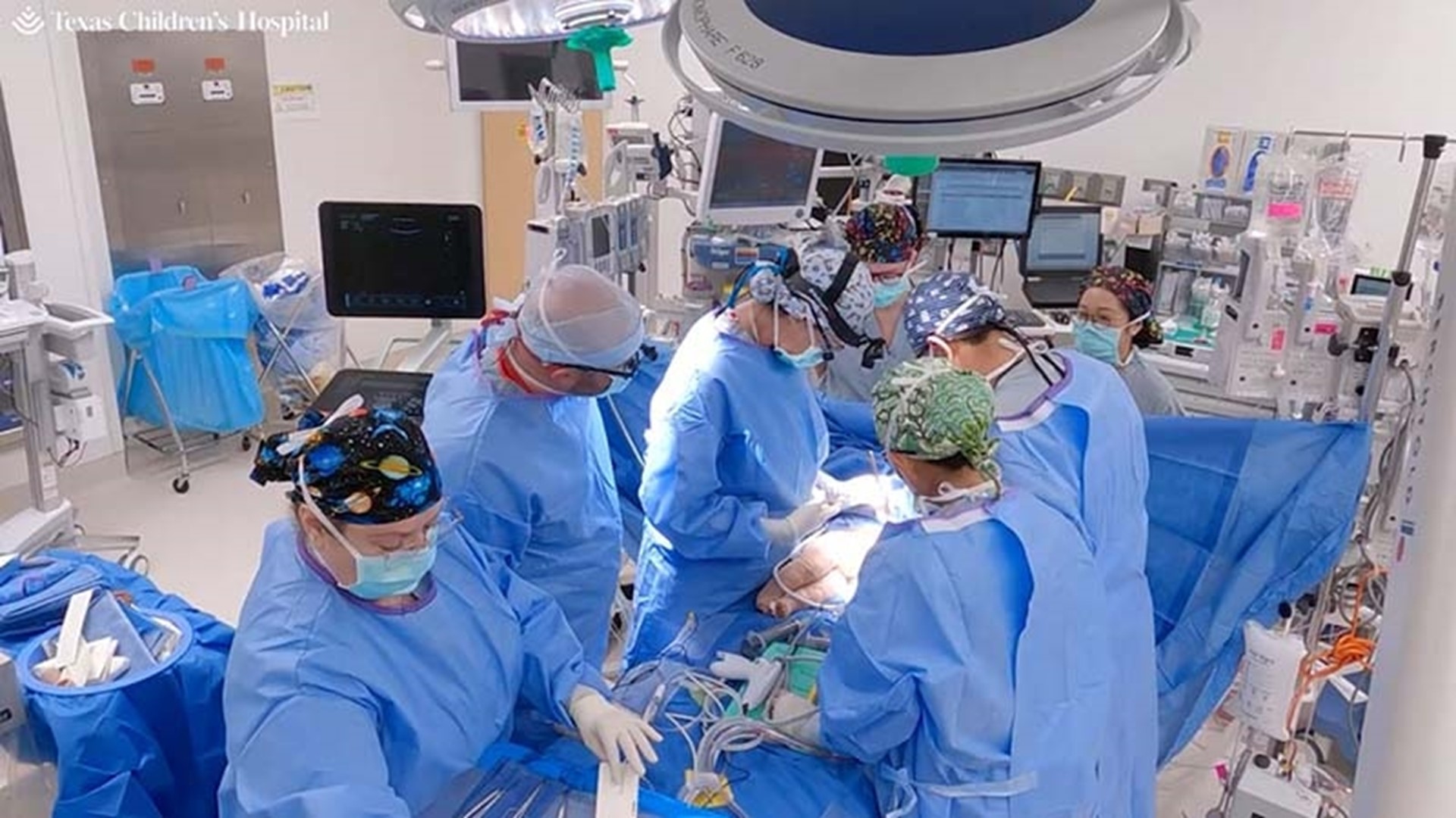 Inside the operating room: Surgery to separate conjoined twins at TCH ...