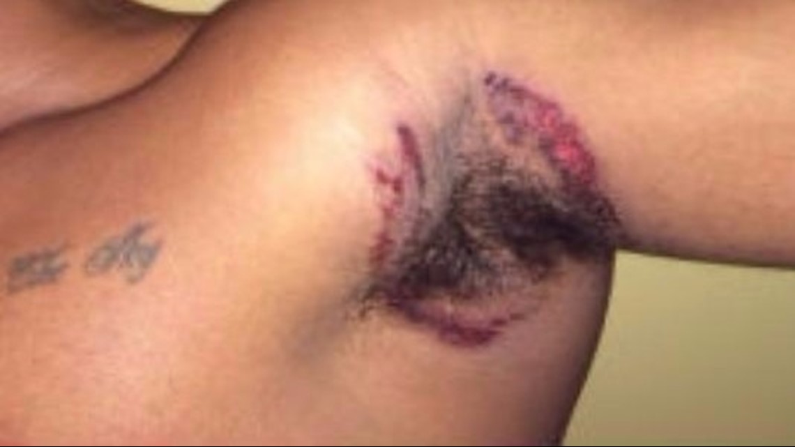 Lawsuit blames Old Spice deodorant for severe armpit rashes | khou.com