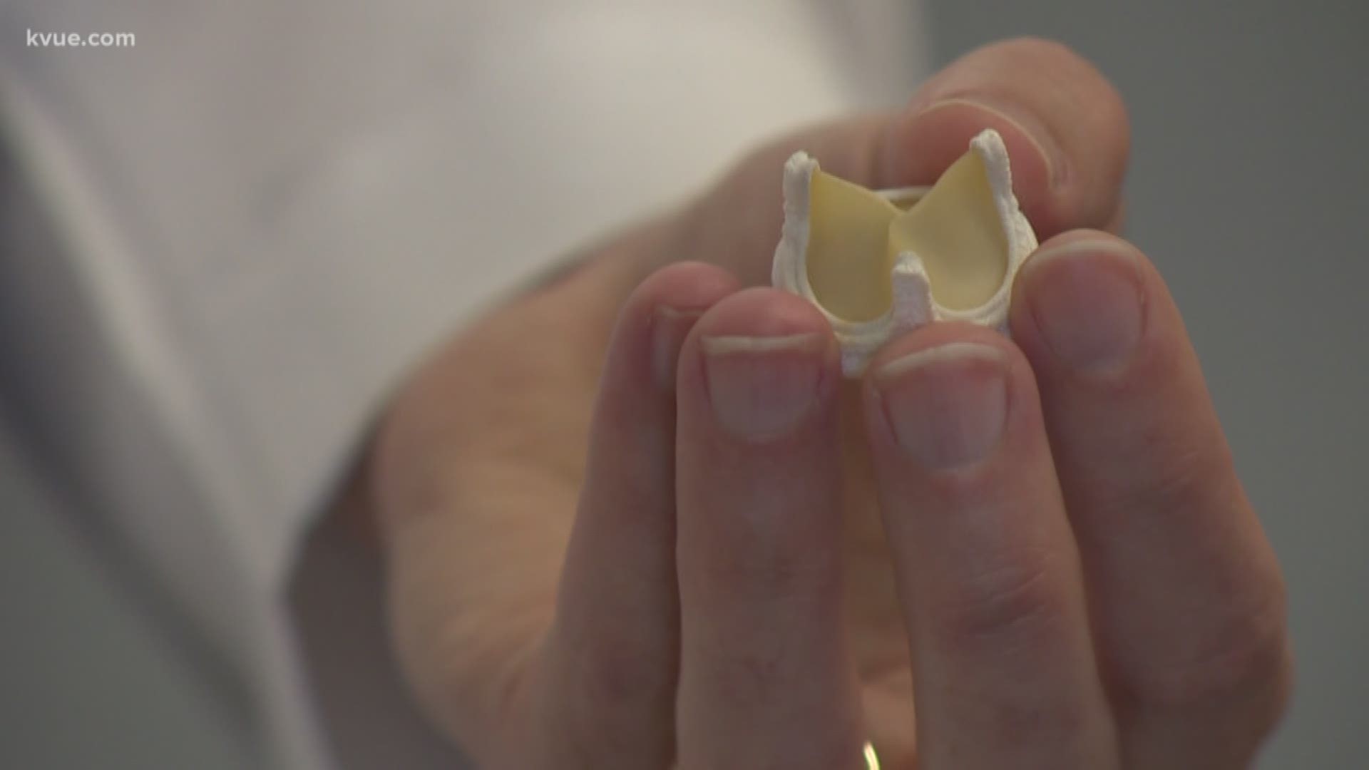 Austin woman first in Central Texas to get new heart valve with cow ...