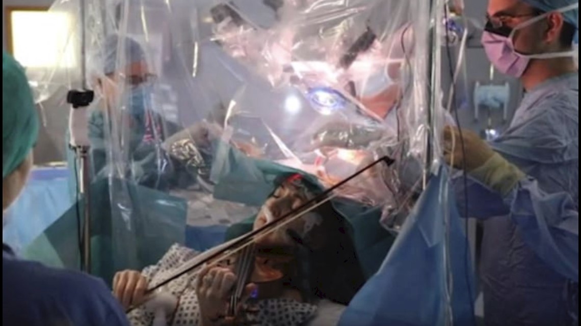 Video: Woman plays violin while getting brain surgery | khou.com